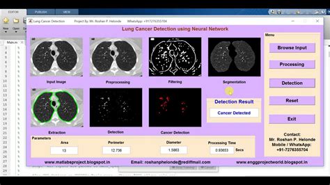 lung cancer detection using neural network matlab project with source code lung cancer
