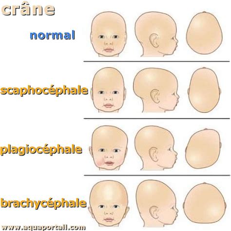 Brachycéphalie définition et explications