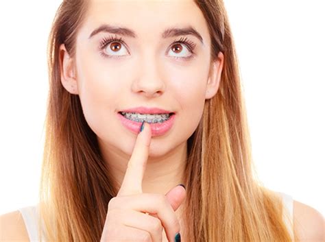 Elastics And Braces Cassinelli Shanker Associates Orthodontics