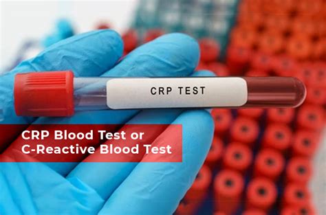 Learn About Crp Blood Test Or C Reactive Protein Blood Test