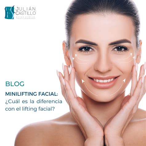 Minilifting y lifting facial Cuál es la diferencia entre estas cirugías