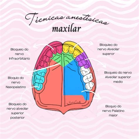 T Cnicas Anest Sicas Maxilar By Beatriz Carvalho Odontologia