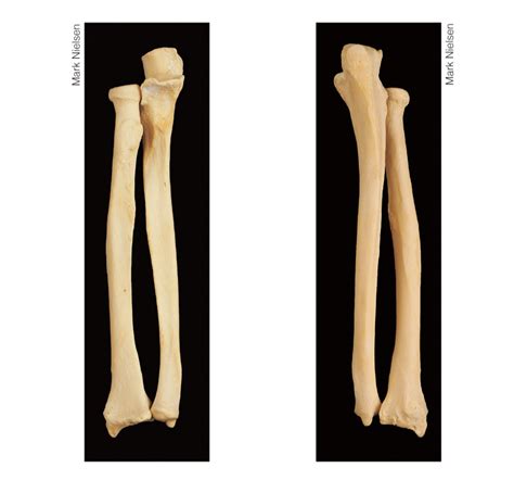 Radius And Ulna Anterior And Posterior View That S So Rad Identifying