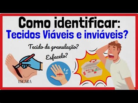 Segredos do Leito da Ferida Decifrando a Granulação e Epitelização
