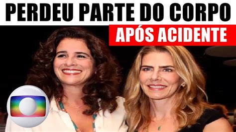 Ex Atriz da Globo PERDEU PARTE do CORPO e aos 64 anos está fora da