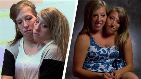 Heartfelt Insights Into Abby And Brittany Hensels Sad News