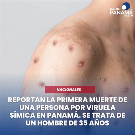 Radio Panam On Twitter Ultimahora El Ministro De Salud Luis