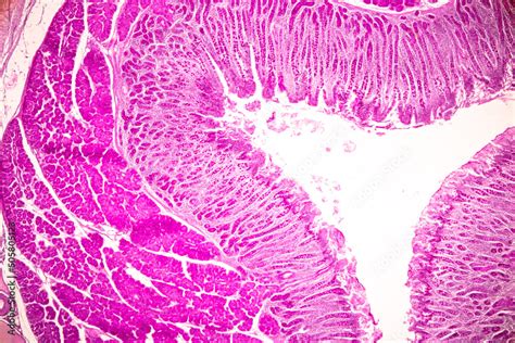 Tissue Of Small Intestine Duodenum And Vermiform Appendix Human Under