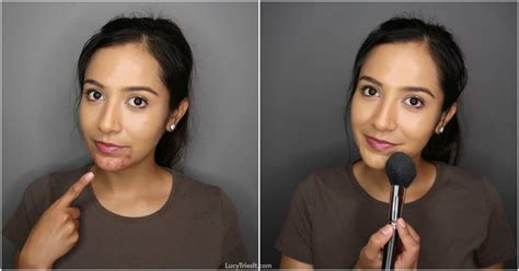 Mac Makeup Causes Cystic Acne Saubhaya Makeup