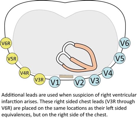 The Ecg Leads Electrodes Limb Leads Chest Precordial Leads