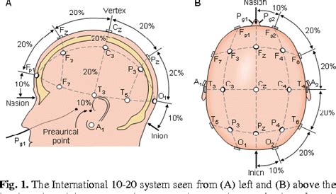 figure 1 from svm classification of epileptic eeg recordings through multiscale permutation