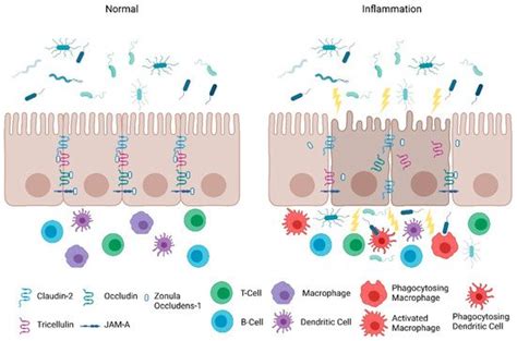 Intestinal Permeability Encyclopedia MDPI