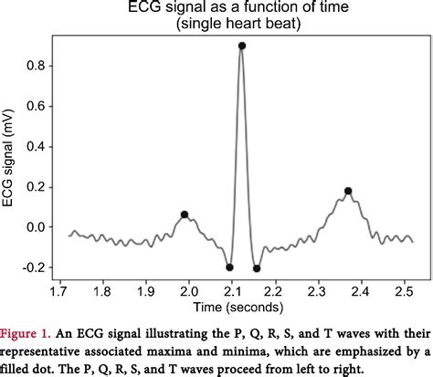 [pdf] preliminary biometrics of ecg signal based on temporal organization through the