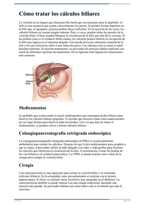 Text C Mo Tratar Los C Lculos Biliares Healthclips Online