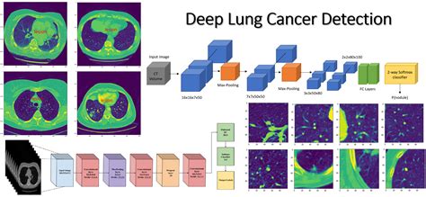 ai free full text deep learning for lung cancer nodules detection and classification in ct scans
