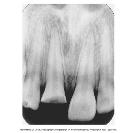 Slides Test Radiography Flashcards Quizlet