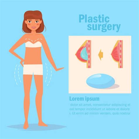 Breast Implant Stock Vectors Royalty Free Breast Implant Illustrations