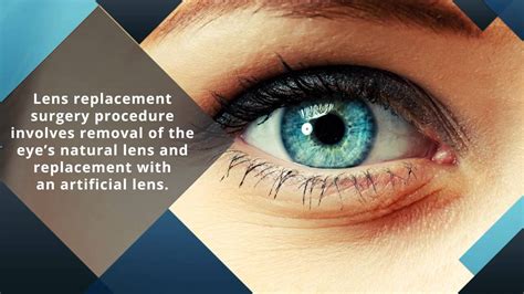Lens Replacement Surgery With Australian Institute Of Eye Surgery YouTube