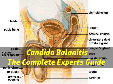 Candida Balanitis Experts Guide Risks Symptoms Creams Treatment
