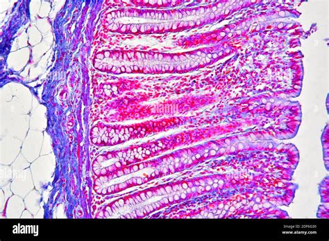 Large Intestine Mucosa And Submucosa Hi Res Stock Photography And