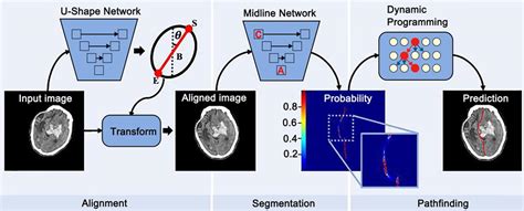 figure 2 from automated detection of 3d midline shift in spontaneous supratentorial