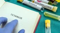Diphtherie Ursache Symptome Behandlung Gesund Bund De