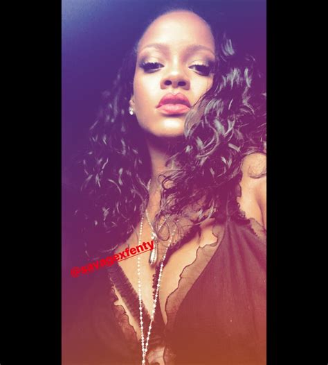 Foto Rihanna Est Progredindo Na Recupera O De Acidente Ela Est Se