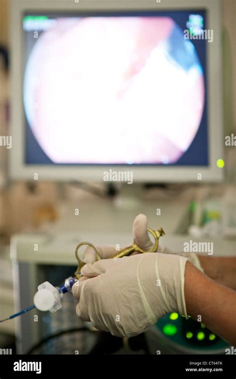 Biopsie probenahme Fotos und Bildmaterial in hoher Auflösung Alamy