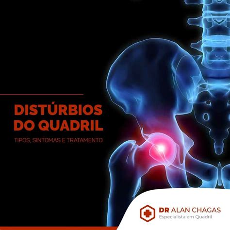 Dist Rbios Do Quadril Tipos Sintomas E Tratamento Dr Alan Chagas