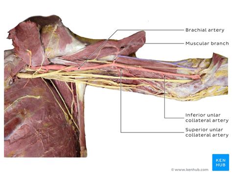 Brachial Artery Injury Clinical Case Anatomy Causes Kenhub