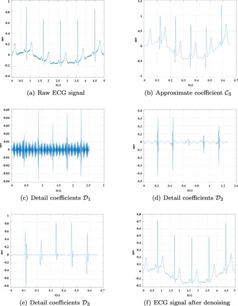 an example of ecg signal denoising download scientific diagram