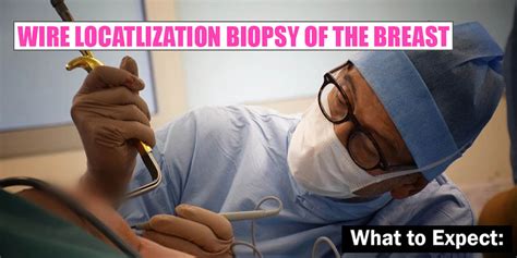 What To Expect Wire Localization Biopsy Of The Breast Fight Like A Girl