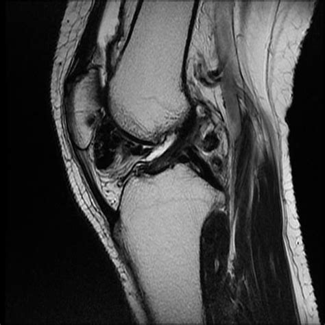 Image Radiopaedia Org
