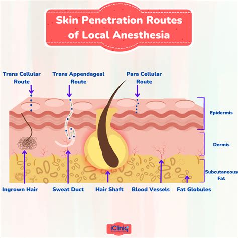 What Is Ester Type Topical Anesthetics