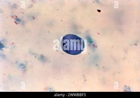 This Photomicrograph Of A Trichrome Stained Specimen Revealed A Mature