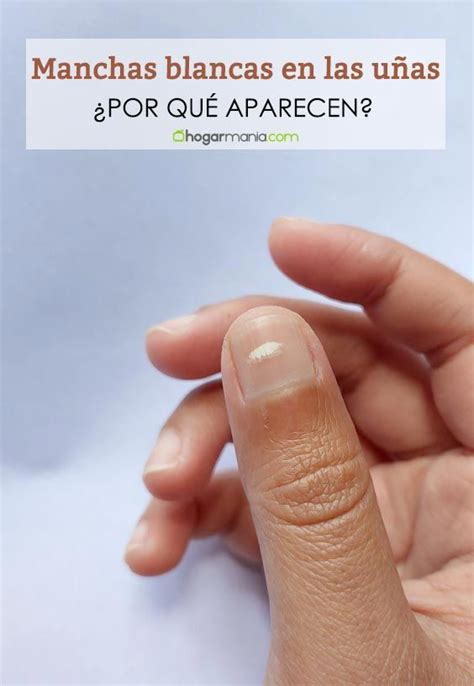 Manchas blancas en las uñas por qué aparecen Te contamos por qué
