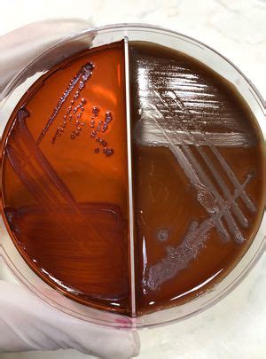Pseudomonas Aeruginosa On EMB And Blood Agars MEDizzy