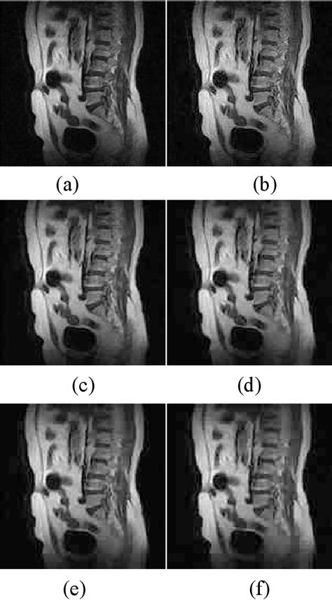 figure 1 from medical image compression framework based on compressive sensing dct and dwt