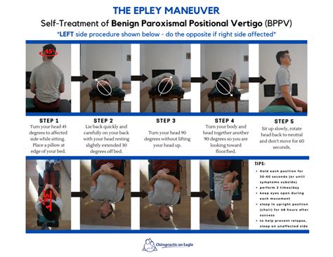 Diagram Of Epley Maneuver For Vertigo