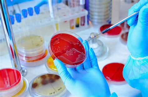 Análisis microbiológico AGQ Labs México