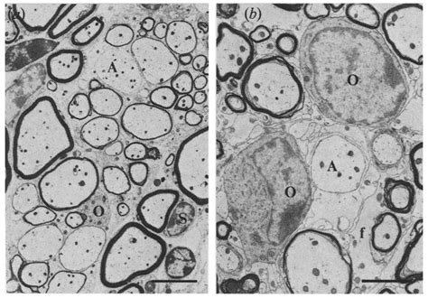 Electron Micrographs Of Same Area As Fig A A Naked Axon A