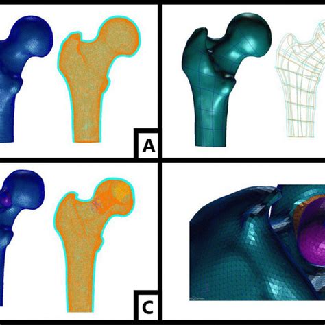 a the finite element model of normal group b the finite element model download scientific