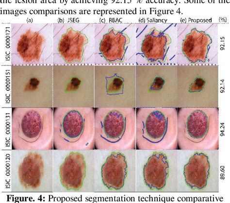 Figure 1 From An Improved Framework By Mapping Salient Features For