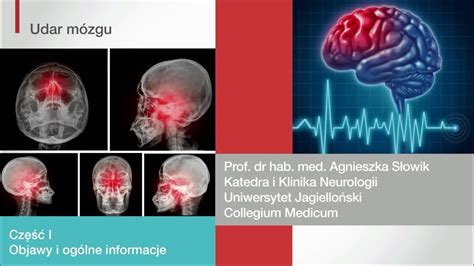Udar mózgu część 1 objawy i ogólne informacje Zdrowie Bayer