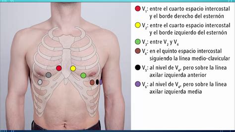 CÓMO Y DÓNDE COLOCAR LOS ELECTRODOS PRECORDIALES YouTube