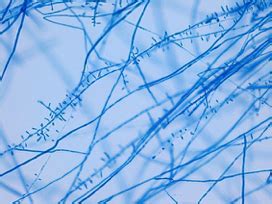 Fungi Yeast Images Flashcards Quizlet