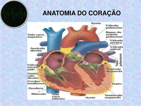 PPT ARRITMIAS CARDÍACAS PowerPoint Presentation free download ID