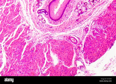 Stratified Squamous Epithelium Hi Res Stock Photography And Images Alamy