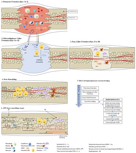 Fracture Healing In Healthy Bone Encyclopedia MDPI