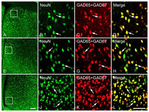 Double Fluorescence In Situ Hybridization And Immunohistochemistry